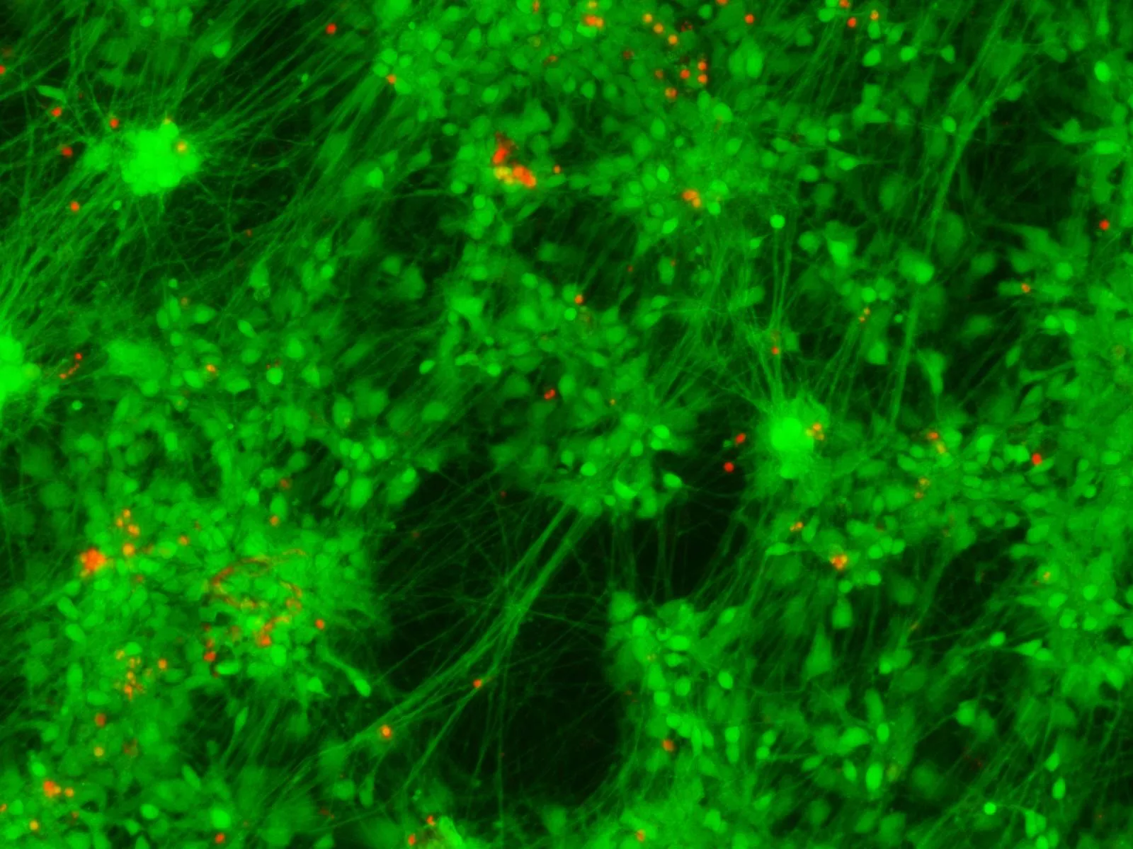 Amyotrophic Lateral Sclerosis SOD1 Model