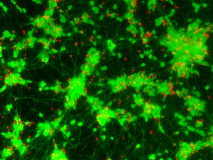 Amyotrophic Lateral Sclerosis SOD1 Model
