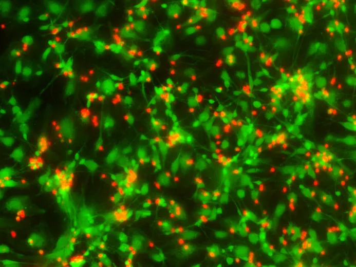 Amyotrophic Lateral Sclerosis SOD1 Model