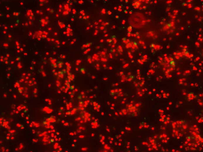 Amyotrophic Lateral Sclerosis SOD1 Model